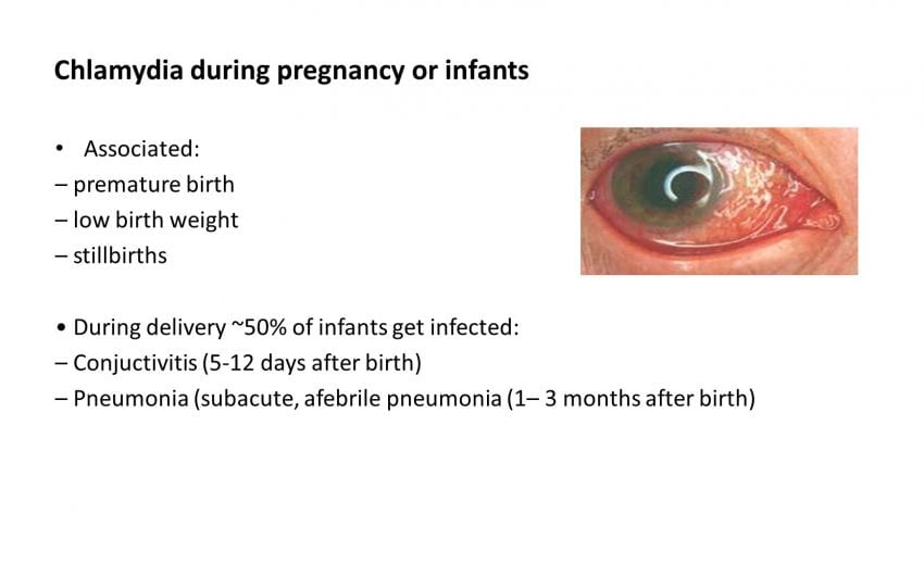 About Chlamydia in Pregnancy - Everything you Need to Know - Opptrends 2024