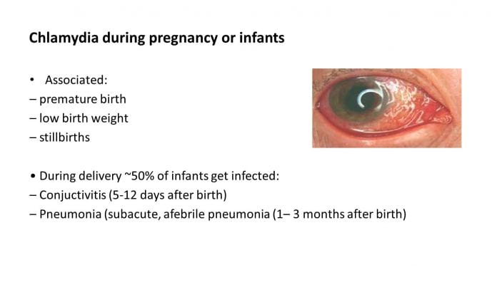 About Chlamydia in Pregnancy - Everything you Need to Know - Opptrends 2025